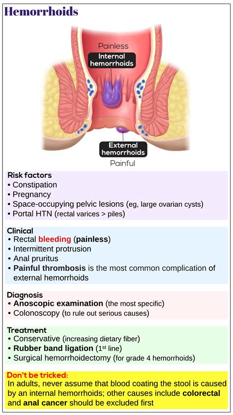 Hemorrhoids Piles Medicine Keys For Mrcps