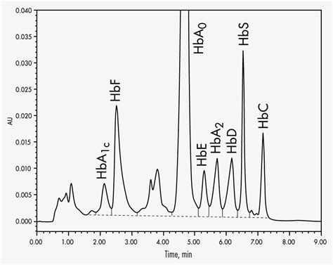 Detection Of Abnormal Hemoglobin Variants By Hplc Method 60 Off