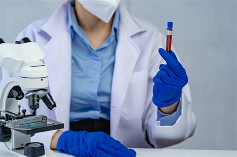 동맥혈 샘플을 검사하는 전문 의사 현미경으로 간호사의 전문 연구 실험실 사무실에서 여성 실험실 조교가 들고 있는 혈액 시험관 클로즈업 간호사에 대한 스톡 사진 및 기타