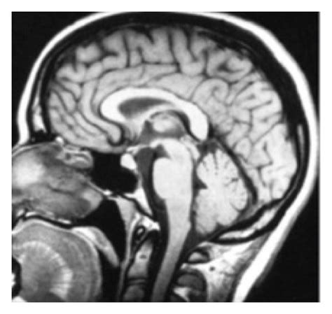 Schematic Diagram Of Mri Reconstruction A K Space Spectral Image Download Scientific