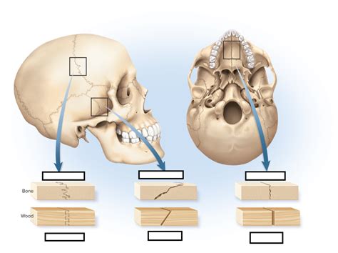 Chapter Sutures Diagram Quizlet
