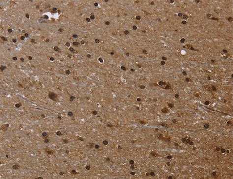 Anti Flna Filamin A Antibody Rabbit Anti Human Polyclonal Lsbio