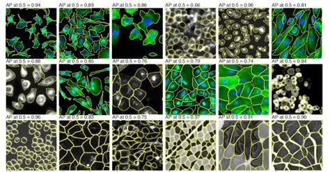 Iss空间转录组的细胞分割算法汇总stardist、cellpose、qupath、scs空间组学 Iss Csdn博客