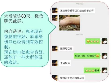 跟腱断裂术后继发感染的诊治，建议收藏！ 德医医学 助力医学教育发展！