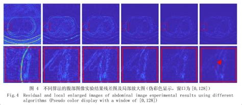 Ct Theory And Applications On Linkedin Sparse Reconstruction Of Computed Tomography Images With
