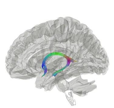Fornix Neuroanatomy Wikipedia
