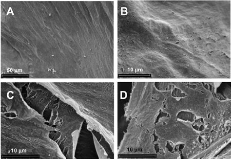 Scanning Electron Micrographs Showing Peritrophic Matrix Pm Of Fall