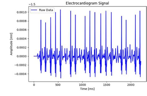 Figure 1 From Classification Of Ecg Signals Using Decision Trees And