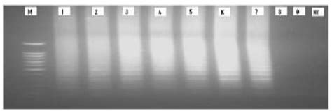 Electrophoresis Analysis Of Lamp Amplified Products After Crude Dna Download Scientific Diagram