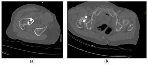 Symmetry Special Issue Multidimensional Signal Processing And Its Applications