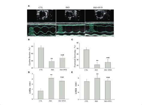 Isoproterenol Iso Decreases Cardiac Function A Representative