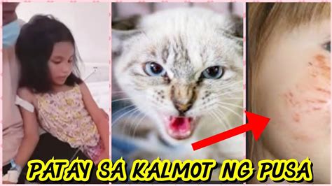Bata Pumanaw Sa Kalmot Ng Pusacat Rabies Youtube