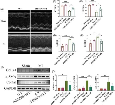 Bmp6 Knockdown Enhances Cardiac Fibrosis In A Mouse Myocardial Infarction Model By Upregulating