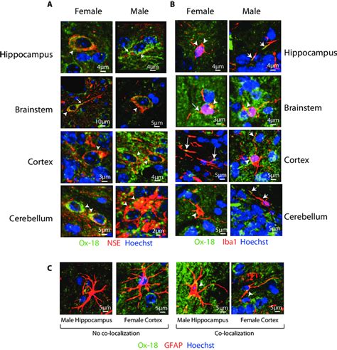 Cellular Localization Of Mhci In Aged Neurons Microglia And Download Scientific Diagram