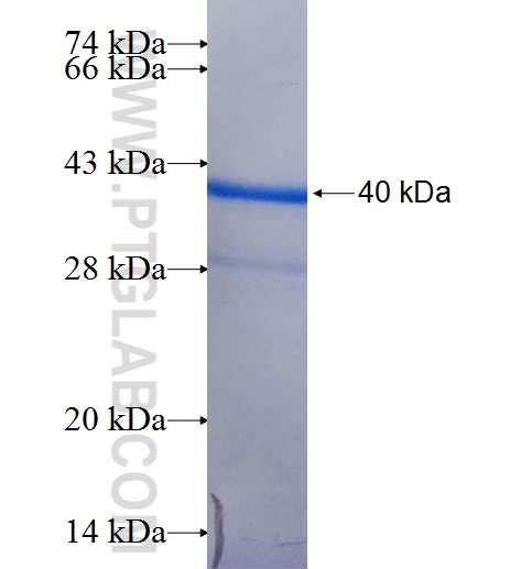 Alms1 Fusion Protein Ag26100 Proteintech