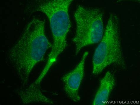 Keap1 Antibody Cl488 60027 Proteintech 武汉三鹰生物技术有限公司