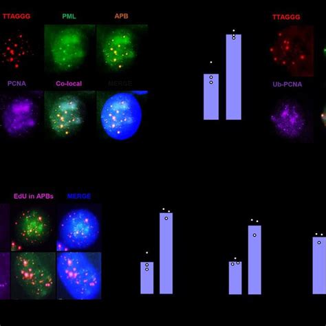 Ub Pcna Increases Apbs With Dna Synthesis In The G2 Phase Of Alt