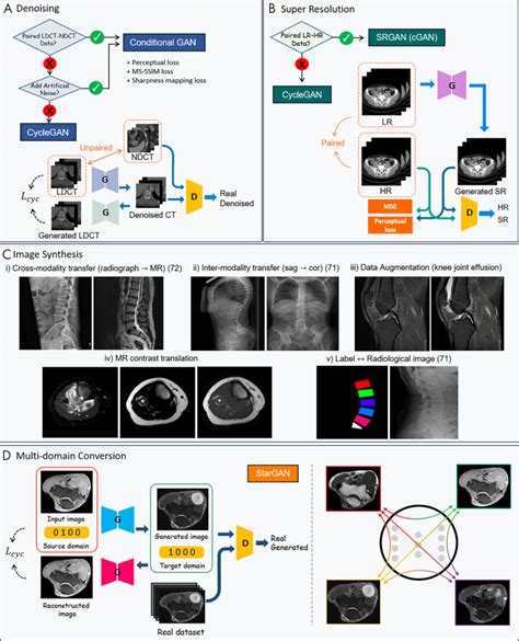 Deep Generative Adversarial Networks Applications In Musculoskeletal Imaging Pmc