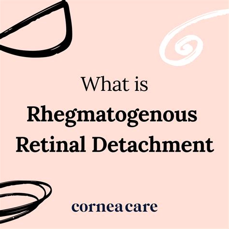 Rhegmatogenous Retinal Detachment Definition Corneacare