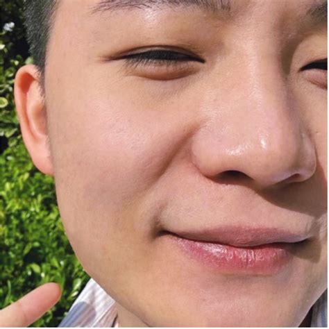 【男生毛孔粗大必看】男士收缩毛孔用什么最好最有效？医学生教你4步，1个月改善男生毛孔粗大、细腻紧致皮肤！ 知乎