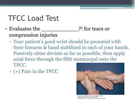 Ppt Hand And Wrist Injury Evaluation Guide Powerpoint Presentation Id