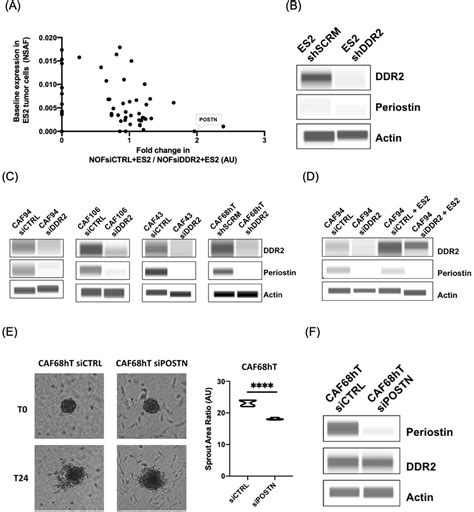 Figure 2 From Ddr2 Expression In Cancer Associated Fibroblasts Promotes