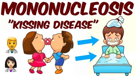 Mononucleosis Warning Signs Fatigue Fever And Swollen Glands Youtube