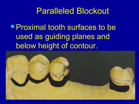 27 Rpd Lab Procedures Ppt