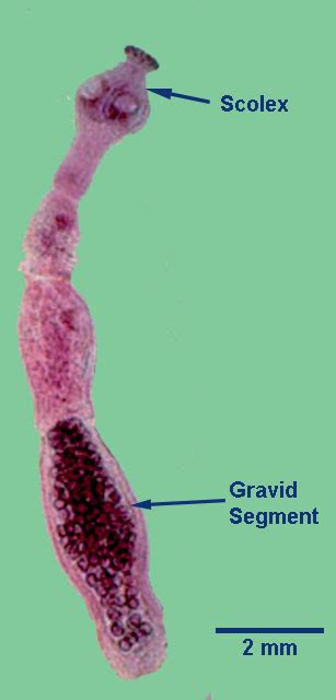 Echinococcus Granulosus Scolex
