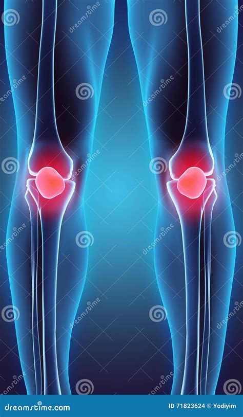 3d Illustration Of Patella Medical Concept Stock Illustration