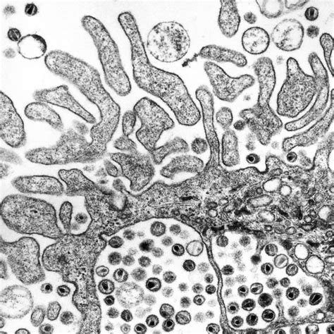 Sessions 10 15 Gonococcus