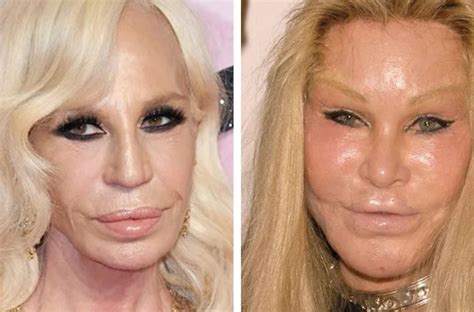 Why Did They Do It Popular Women Who Ruined Their Looks With