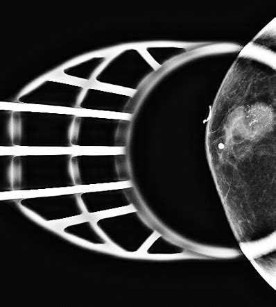 Image Radiopaedia Org