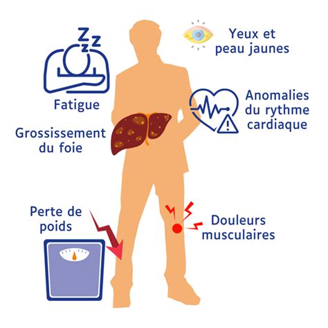 Les hépatites cest quoi Eurofins Biologie Médicale