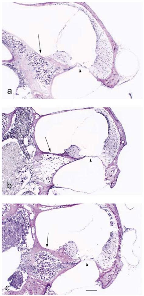 Photomicrographs Of The Cochlear Basal Turn From Mice Of Each Strain