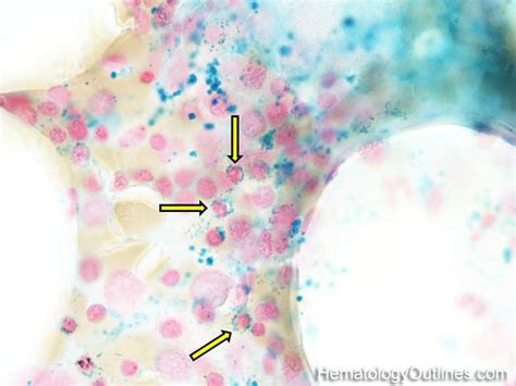 Hematologyoutlines Glossary