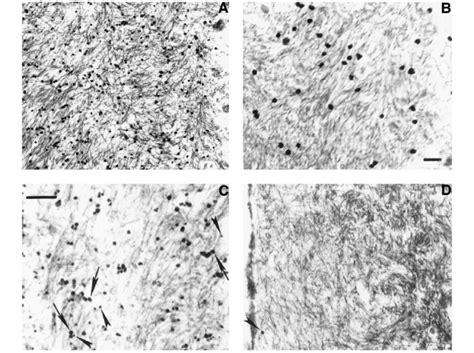 Immunoelectron Microscopy Of Amyloid Fibrils From Cerebral Cortex Of An Download Scientific