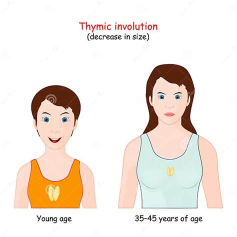 Thymic Involution Decrease Size Of The Thymus With Age Stock Vector