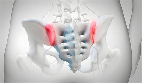 How Long Do Sacroiliac Joint Injections Last