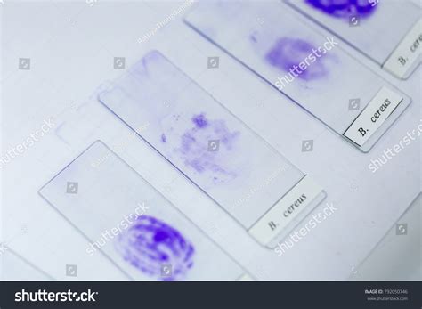 Technique Smear Preparation Microbiology Education Lab Stock Photo Shutterstock
