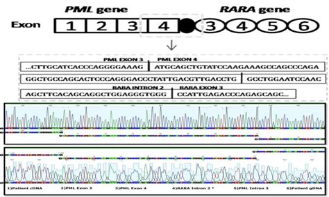 Characterization Of Novel Bcr3 Pml Rara Variant By Sanger Sequencing Download Scientific
