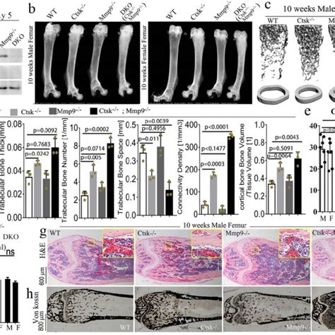 Double Deletion Of Mmp9 And Ctsk Causes Increased Bone Mass And Severe