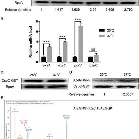 The Activity Of Cspc Is Regulated By Acetylation A Indicated Strains Download Scientific