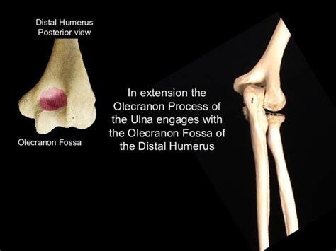 Slideshow Ulna