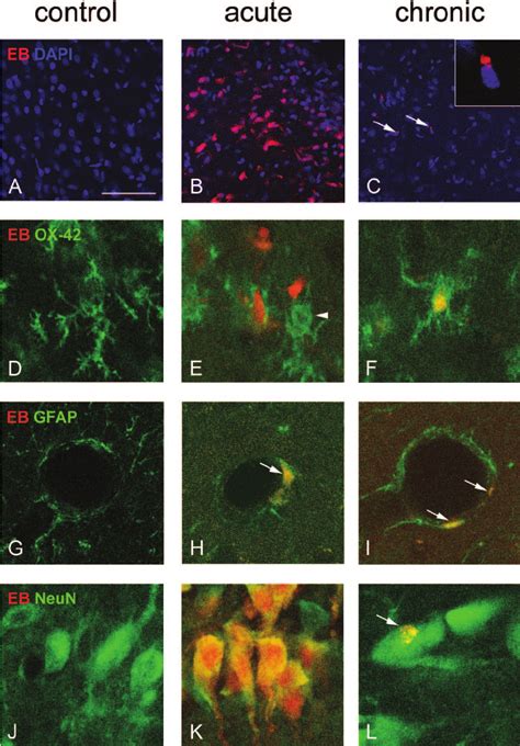 Evans Blue Eb Extravasation During Epileptogenesis In Control Rats