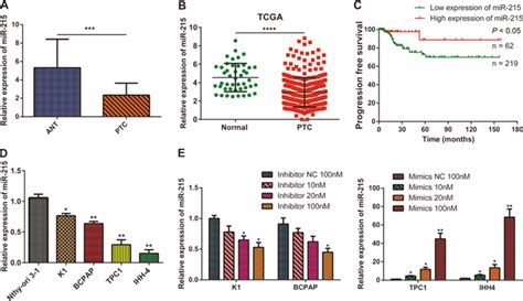 Mir 215 Suppresses Papillary Thyroid Cancer Proliferation Migration