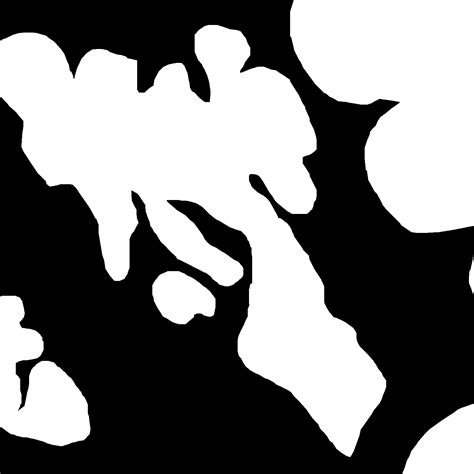 Github Sarah Antilliatensorflow Image Segmentation Rings Prostate Tumor Tensorflow Image