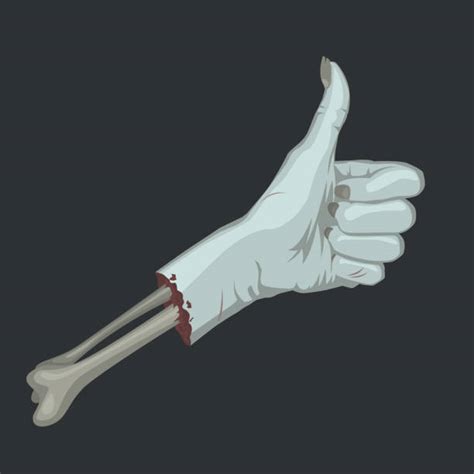 100 Severed Limb Stock Illustrations Royalty Free Vector Graphics