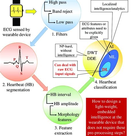 Steps Of Conventional Ecg Heartbeat Classification Download
