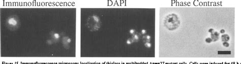 Figure 15 From Giant Peroxisomes In Oleic Acid Induced Saccharomyces